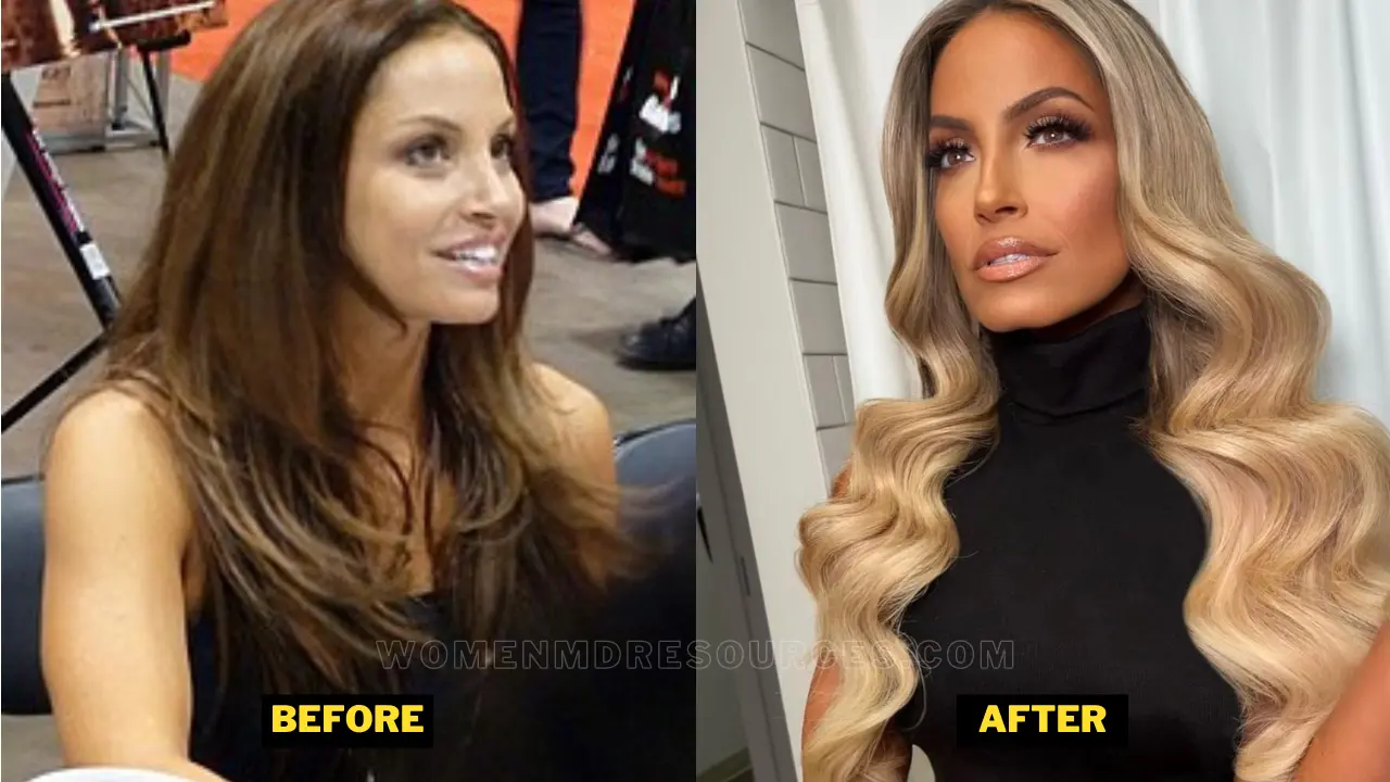 Trish Stratus Plastic Surgery 2023. Now And Then Pictures