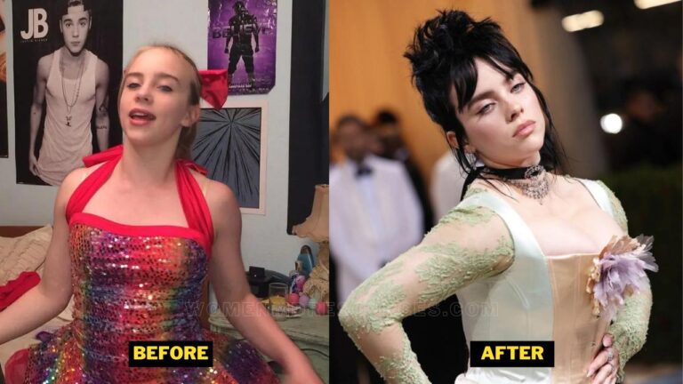 Billie Eilish Plastic Surgery. Her Boob Job Rumors
