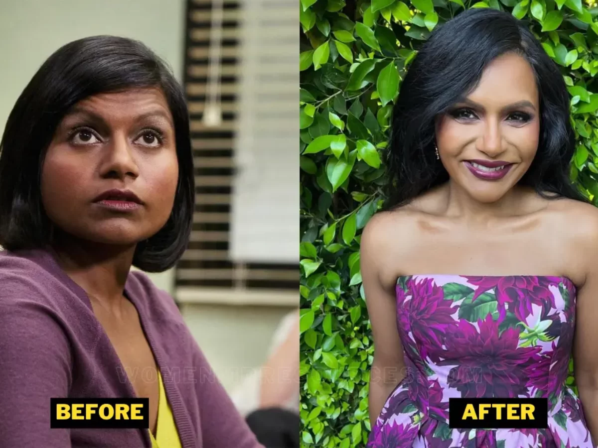 Mindy Kaling Skin Lightening